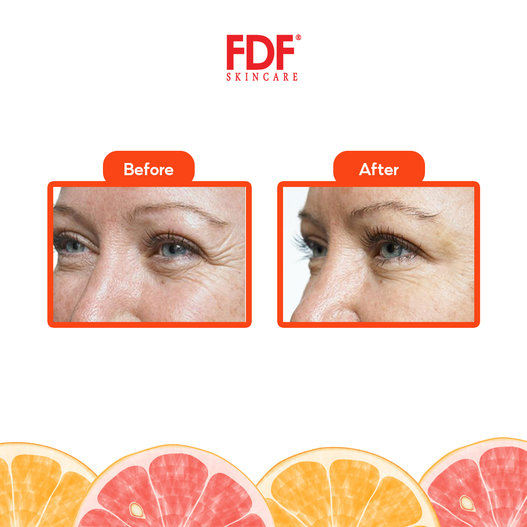 Eye Gel 18g - FDF Skincare